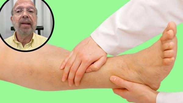 Koka - Pernas inchadas no verão: causas e dicas para aliviar o desconforto